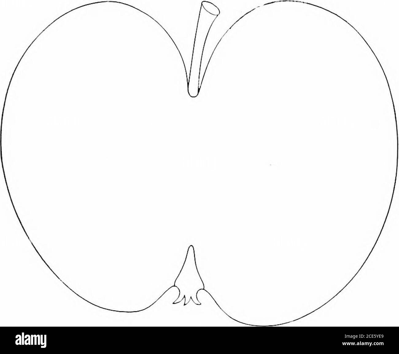Obtuse marginal Black and White Stock Photos & Images - Alamy