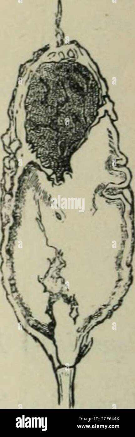 Ergot wheat hi-res stock photography and images - Alamy