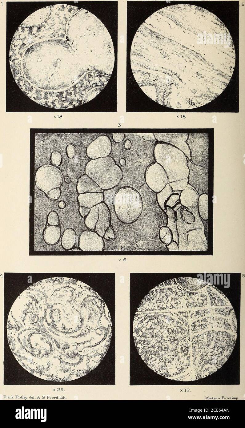 Angular Grains High Resolution Stock Photography and Images - Alamy