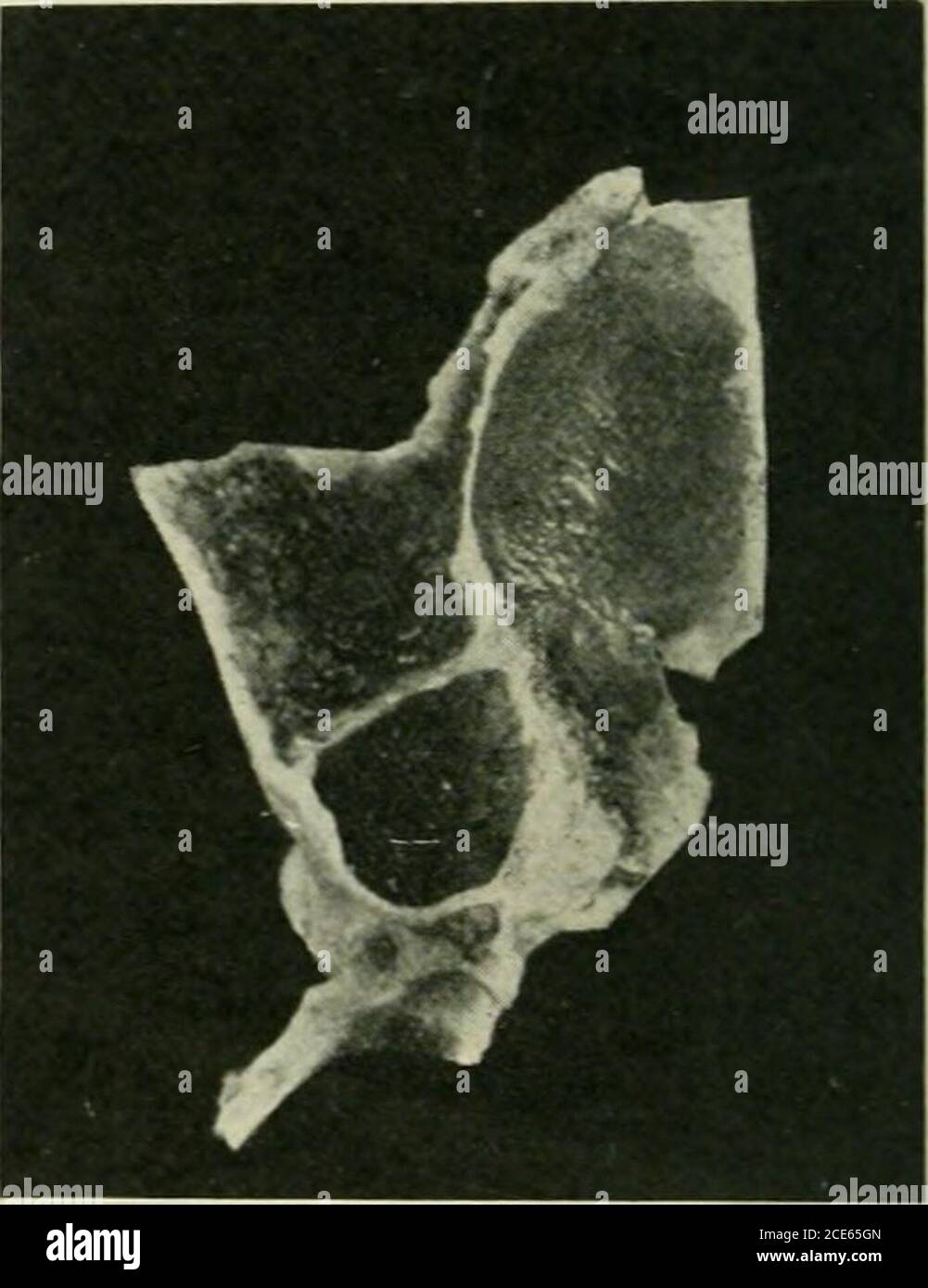 . Journal of anatomy . ¥u.. -.Sliuws septum iu left antrum. Fig. 5 ...