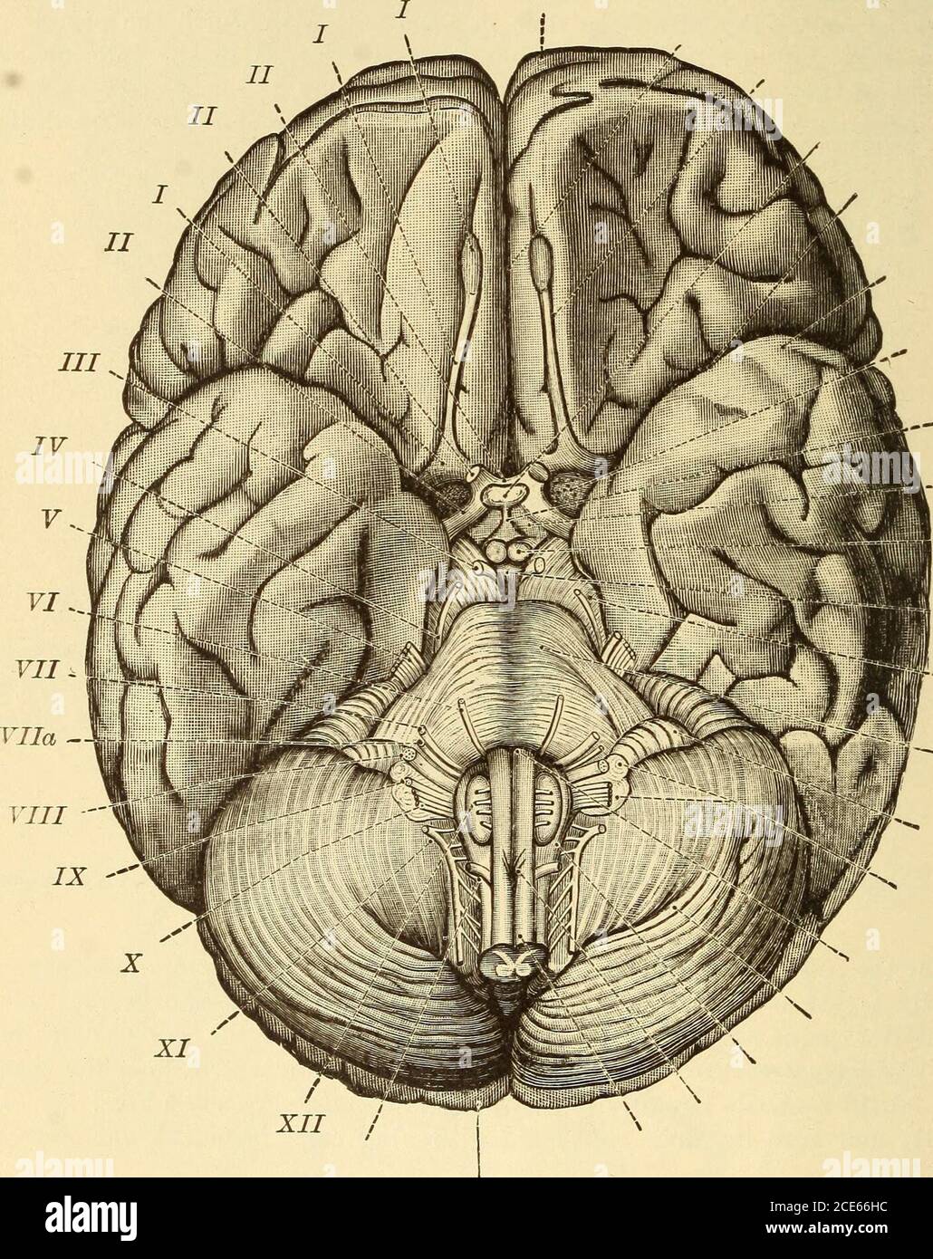 . Diseases of the nervous system . The accumulation of cells just ...