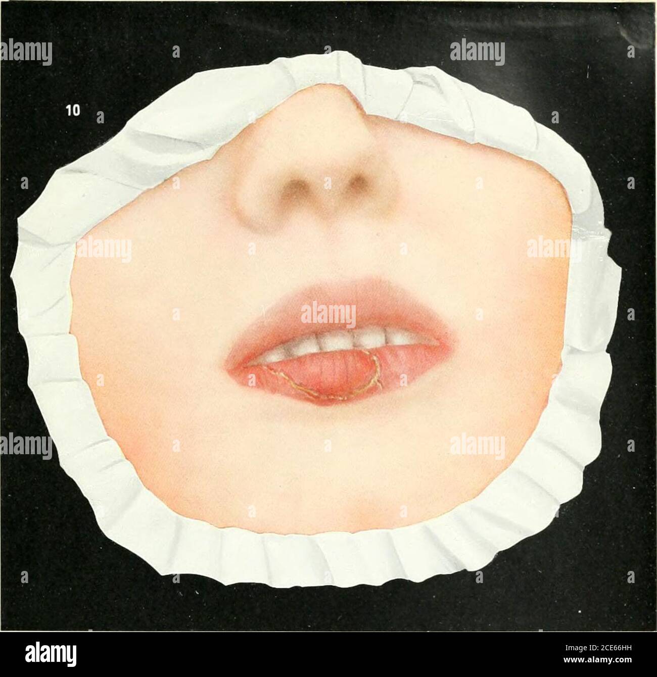 . Diseases of the mouth; for physicians, dentists, medical and dental ...