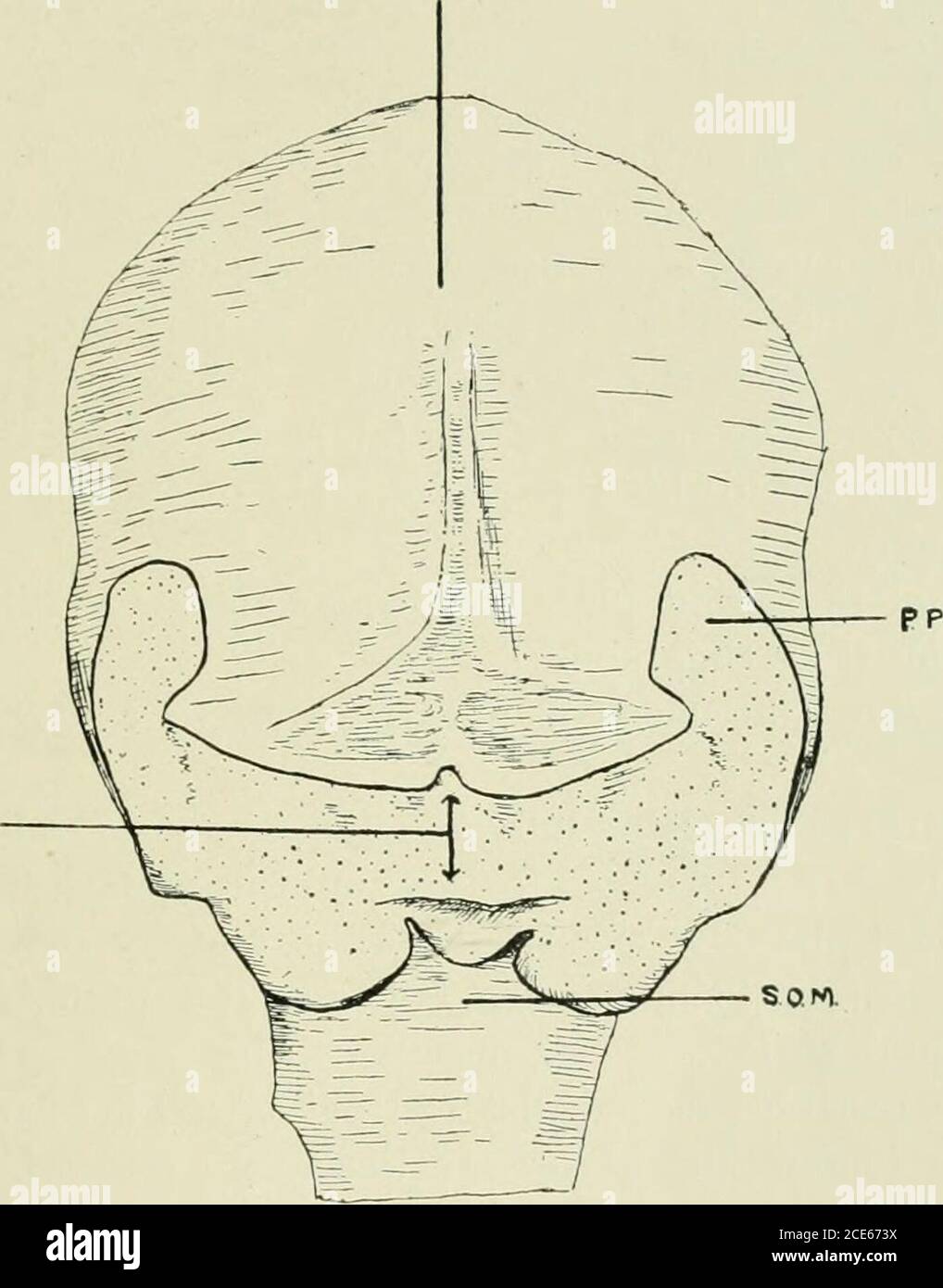 Frontal process of zygomatic bone hi-res stock photography and images ...