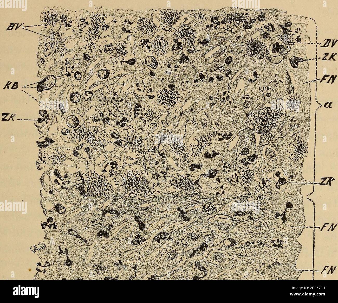 . Diptheria, its nature and treatment . divided in two; free nuclearand ...