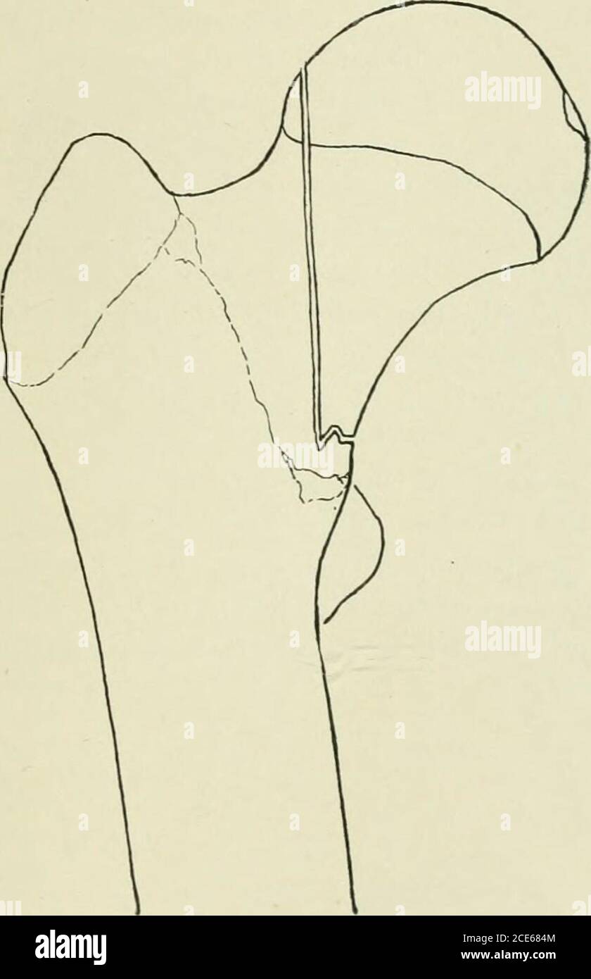 Human neck bending hi-res stock photography and images - Alamy