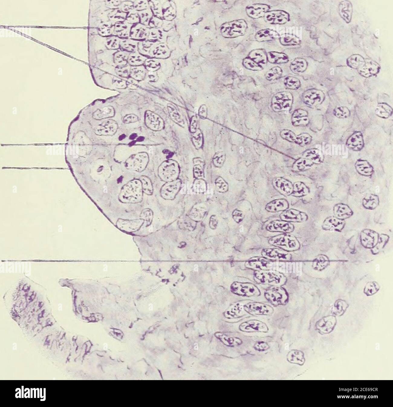 Lumen of glands hi-res stock photography and images - Alamy