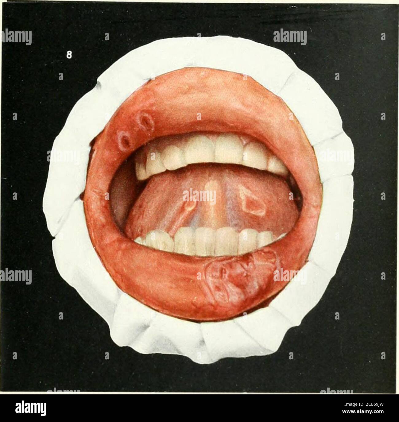 . Diseases of the mouth; for physicians, dentists, medical and dental ...