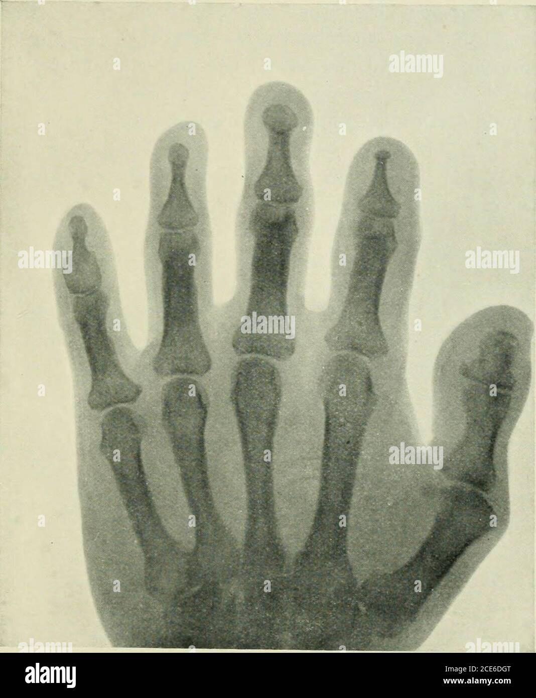 Abnormal ai hi-res stock photography and images - Alamy