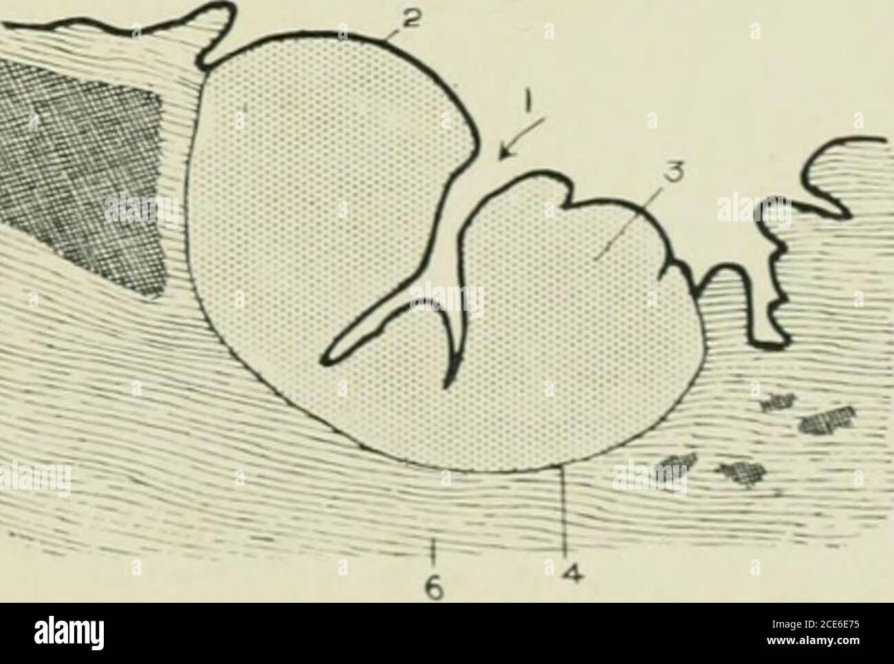 Pars triangularis hi-res stock photography and images - Alamy