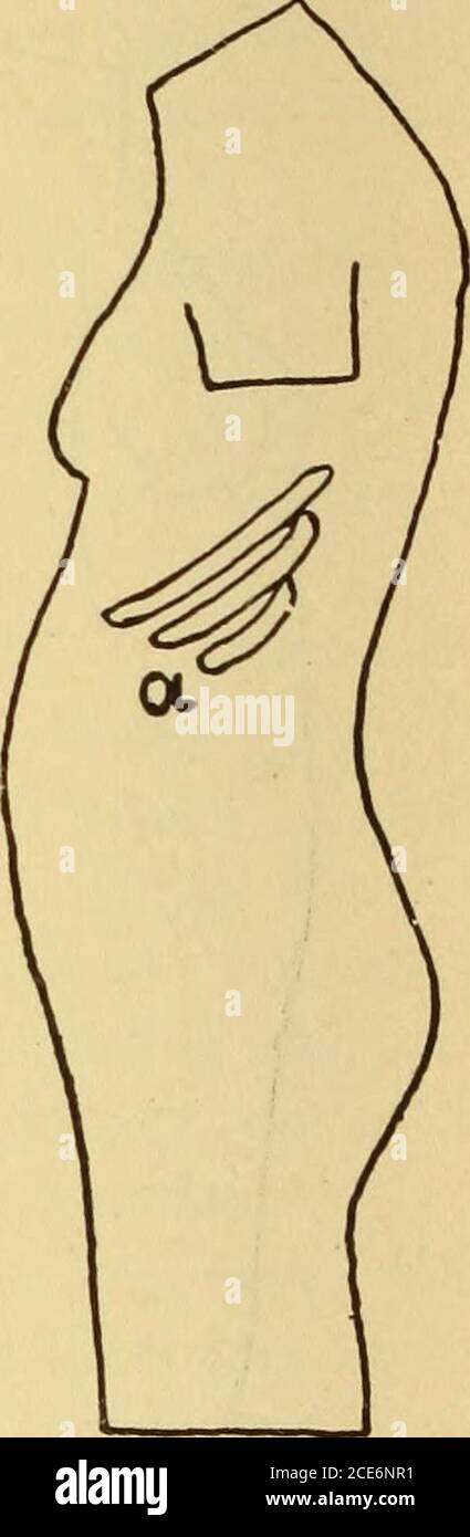 . Dr. Evans' How to keep well; . Fig. 442.—NormalChest with RibsRunning ...