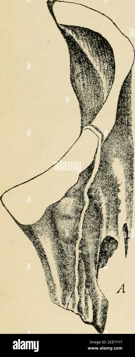 Human heart removed hi-res stock photography and images - Alamy