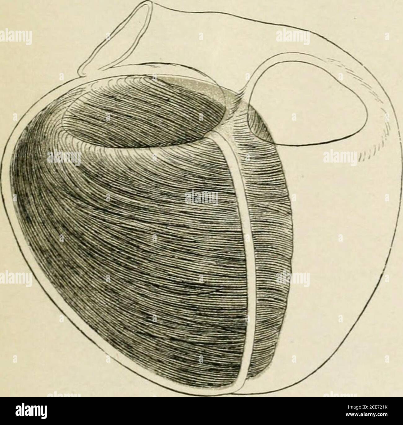 Tendinous ring hi-res stock photography and images - Alamy