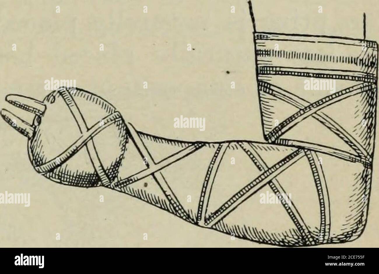 Caestus hi-res stock photography and images - Alamy