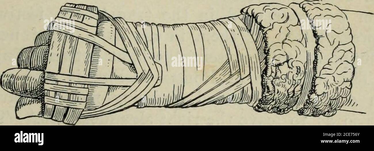 Ancient Greek Boxing Gloves