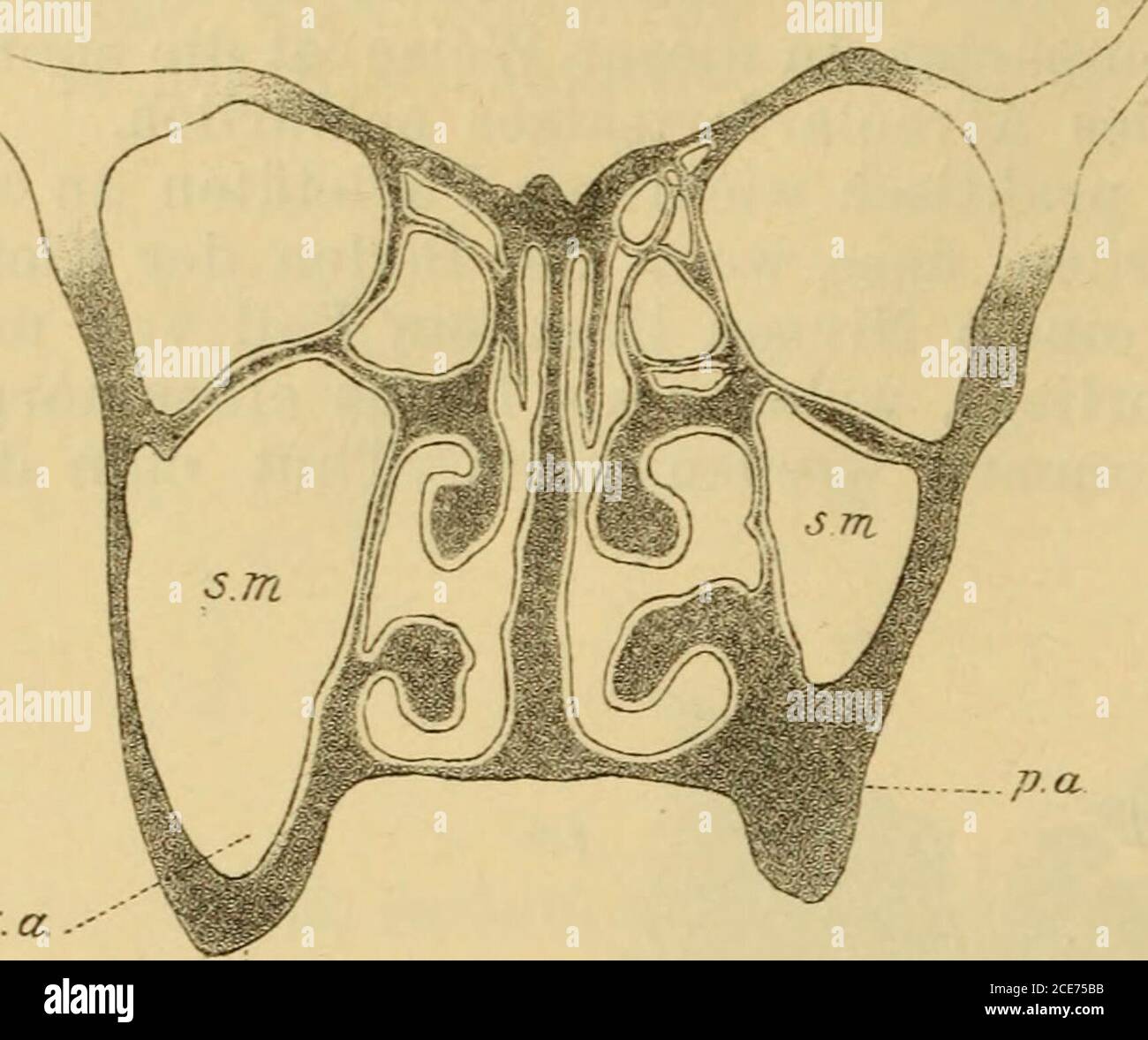 . Pathologie und Therapie der entzündlichen Erkrankungen der ...