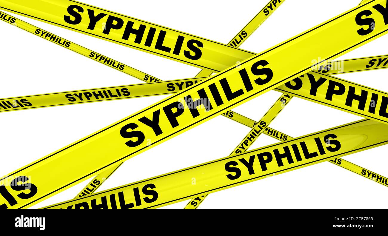 Syphilis. Yellow warning tapes with black words SYPHILIS. Isolated. 3D ...