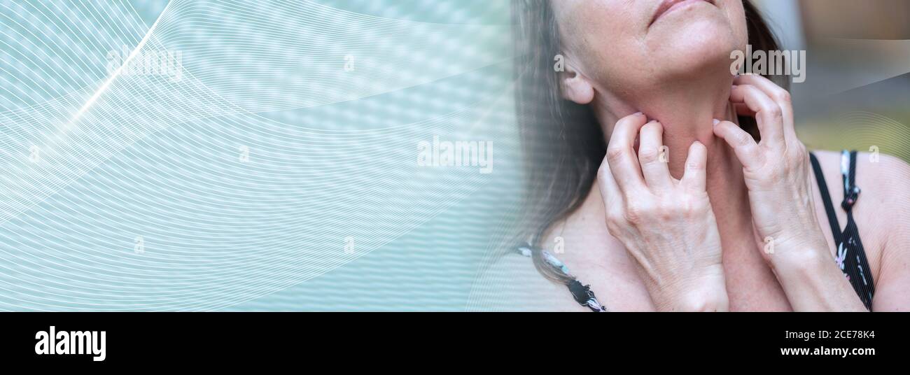 Woman having itchy and scratching her neck; panoramic banner Stock Photo - Alamy