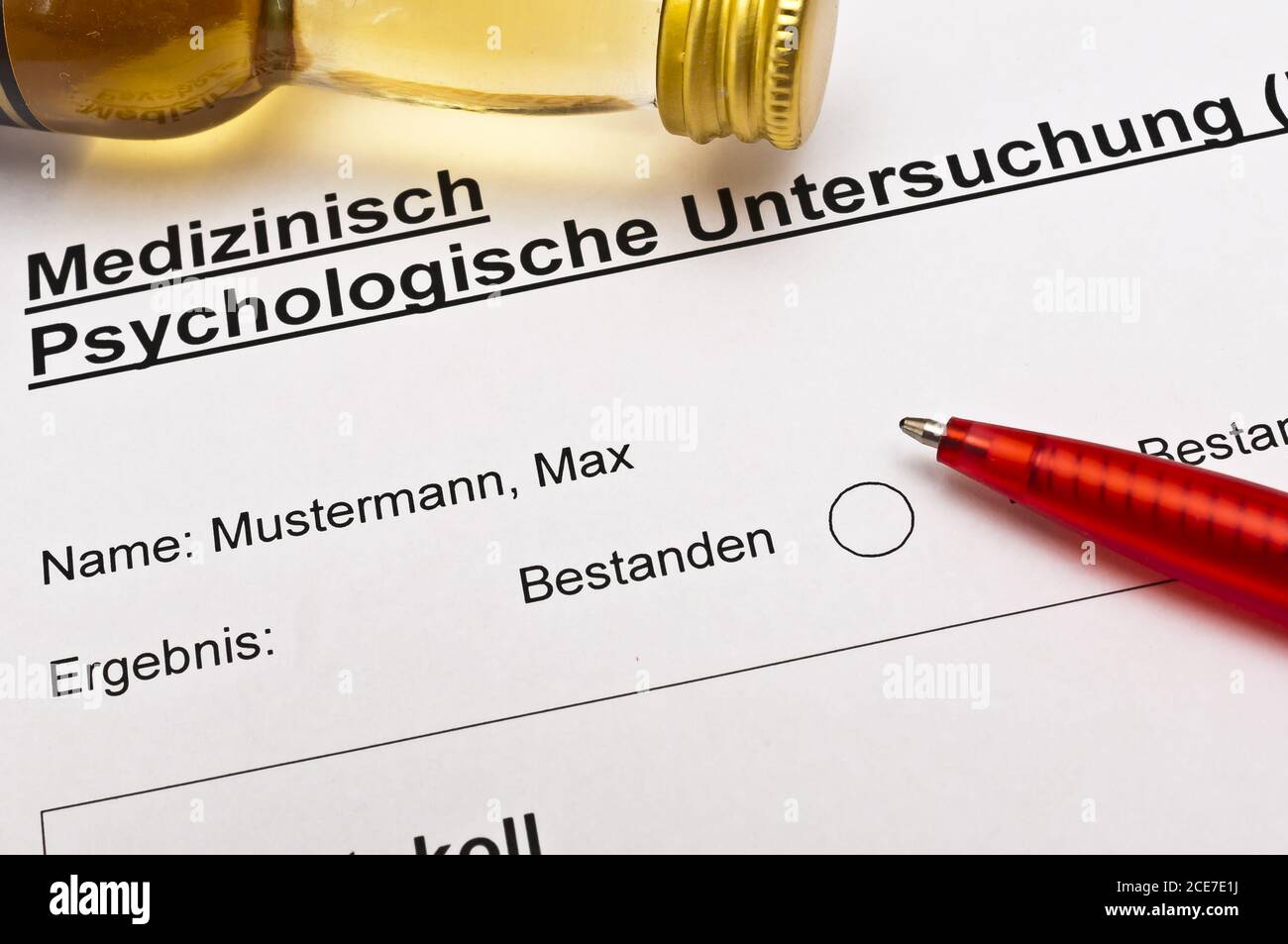 MPU test procedure Stock Photo - Alamy