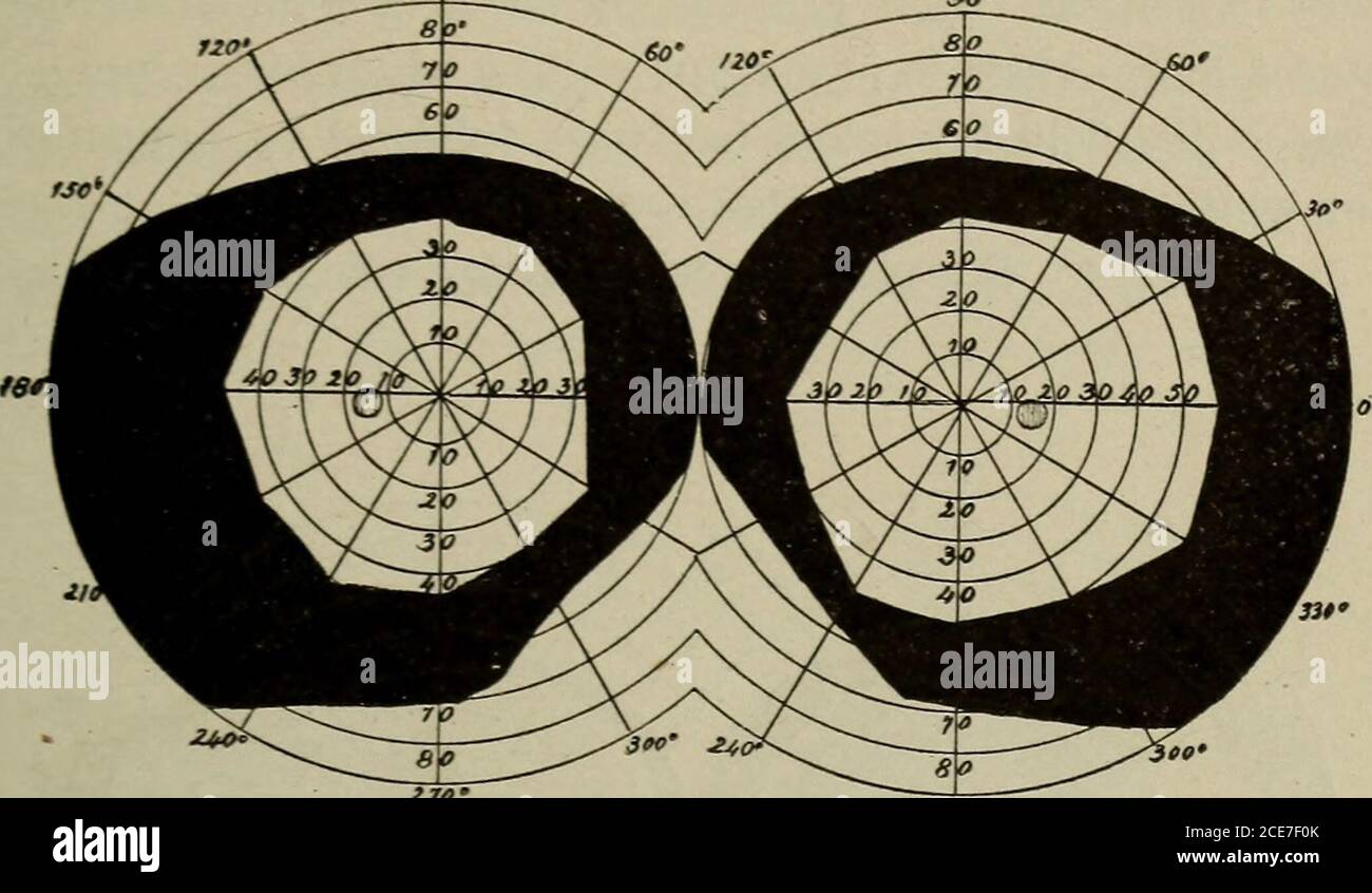 Ocular Motility High Resolution Stock Photography and Images - Alamy