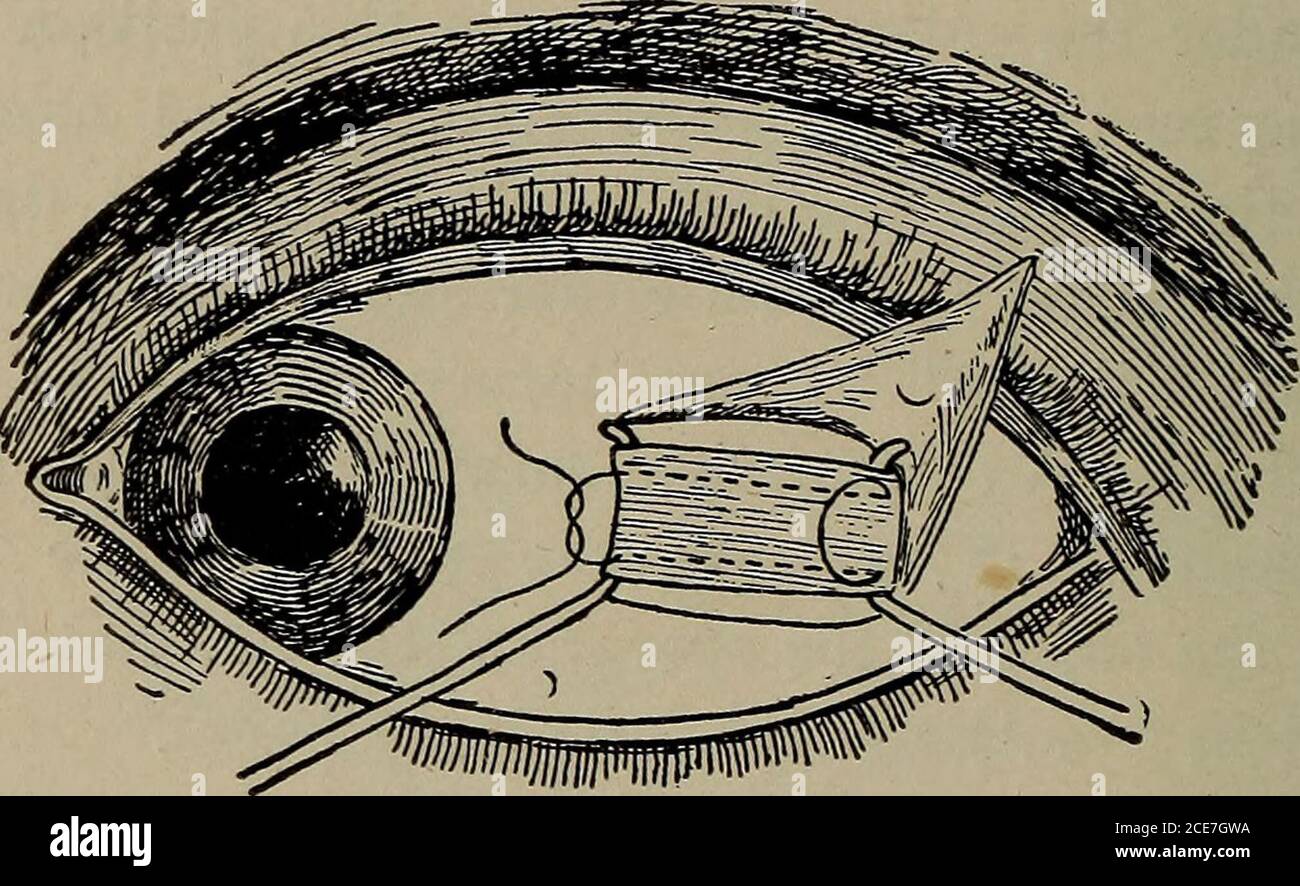 . Refraction and motility of the eye, with chapters on color blindness ...