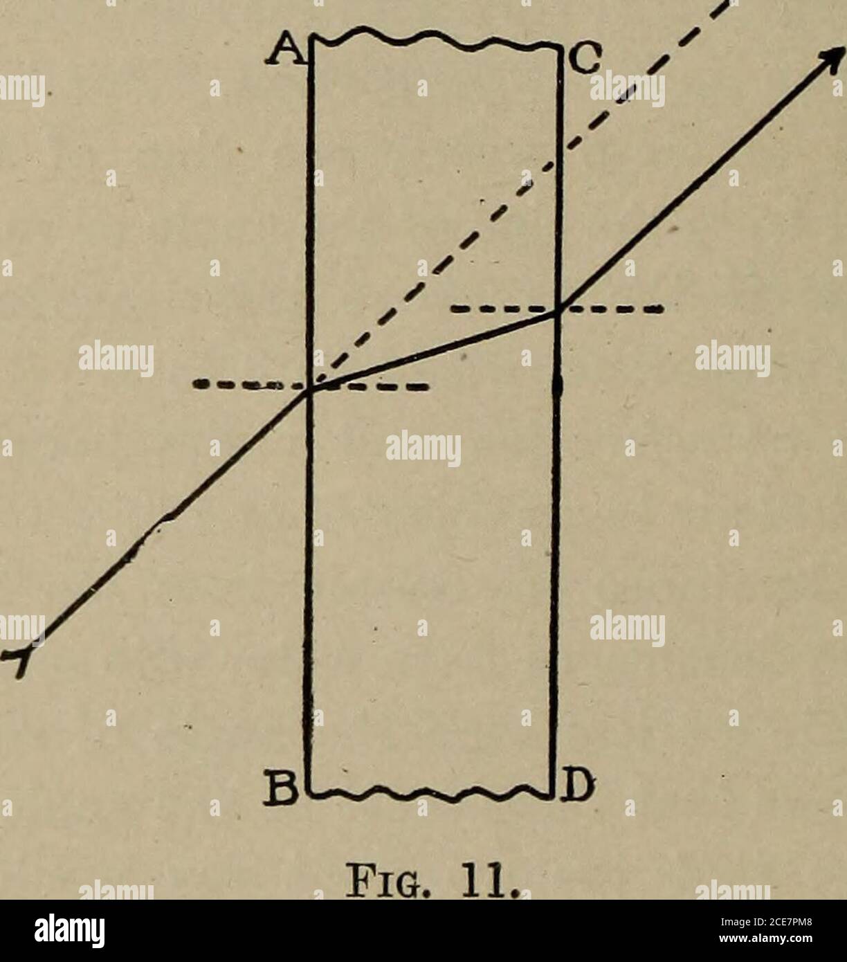 Abcd rule hi-res stock photography and images - Alamy