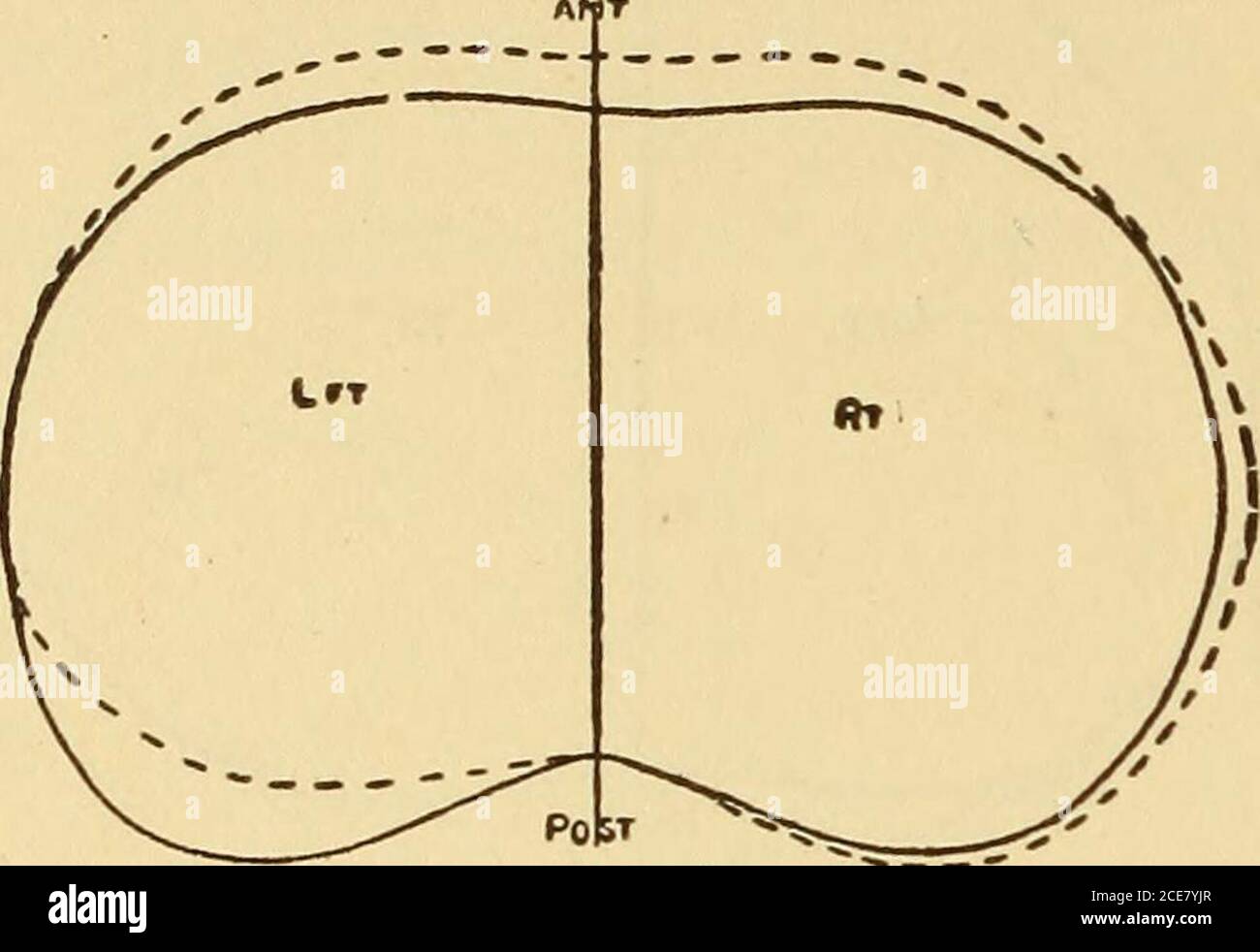 Barrel chested hi-res stock photography and images - Alamy