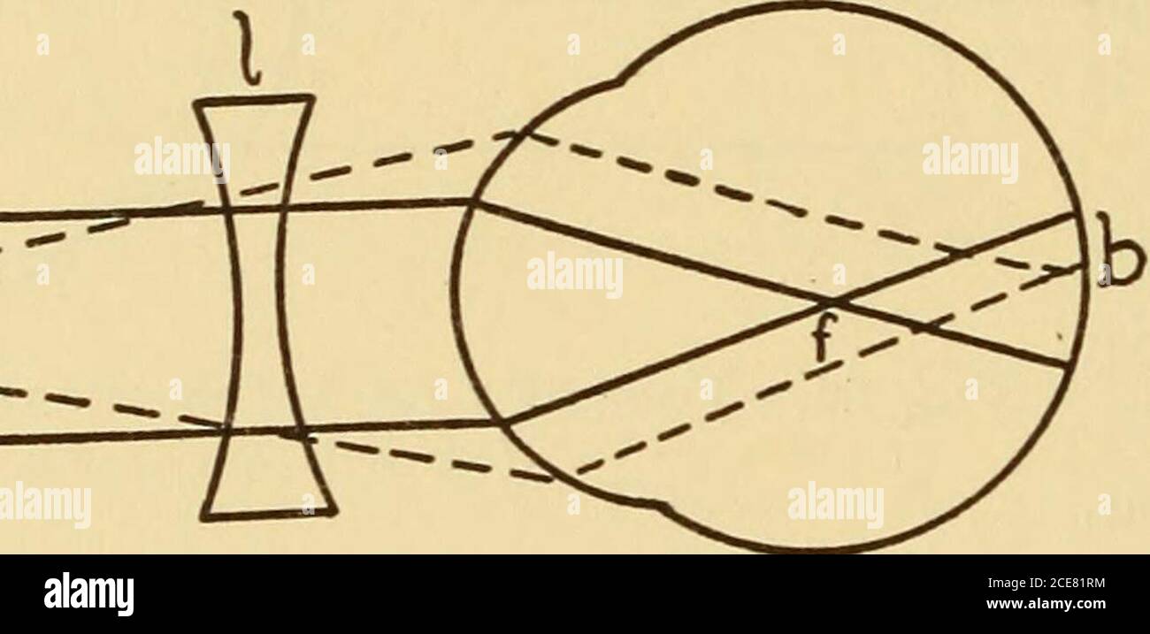 Wassermann Test High Resolution Stock Photography and Images - Alamy