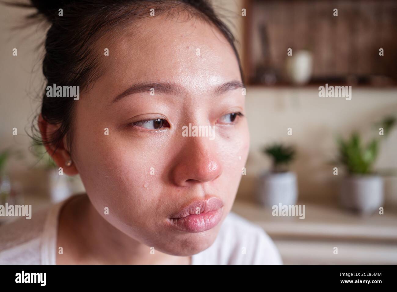 Sick ethnic female crying while having flu and headache looking away ...