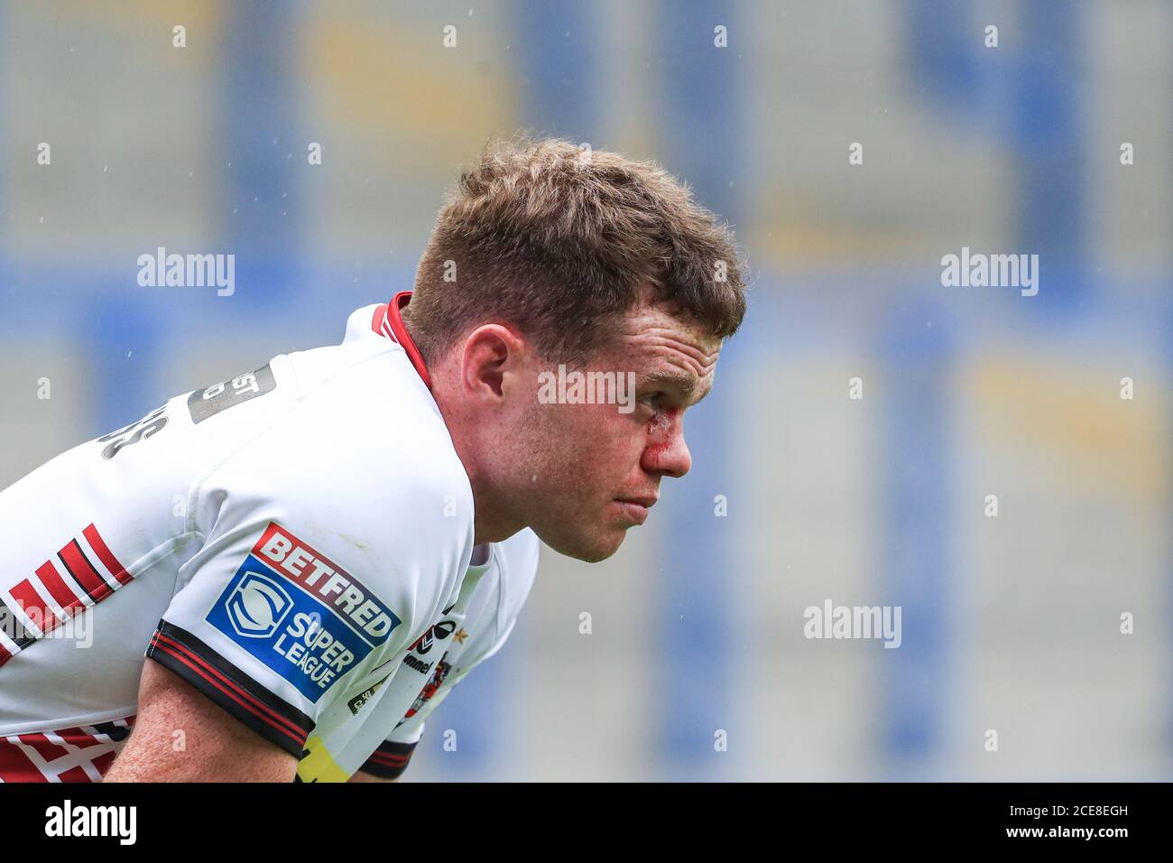 Joe Burgess (5) of Wigan Warriors receives a cut under his right eye ...