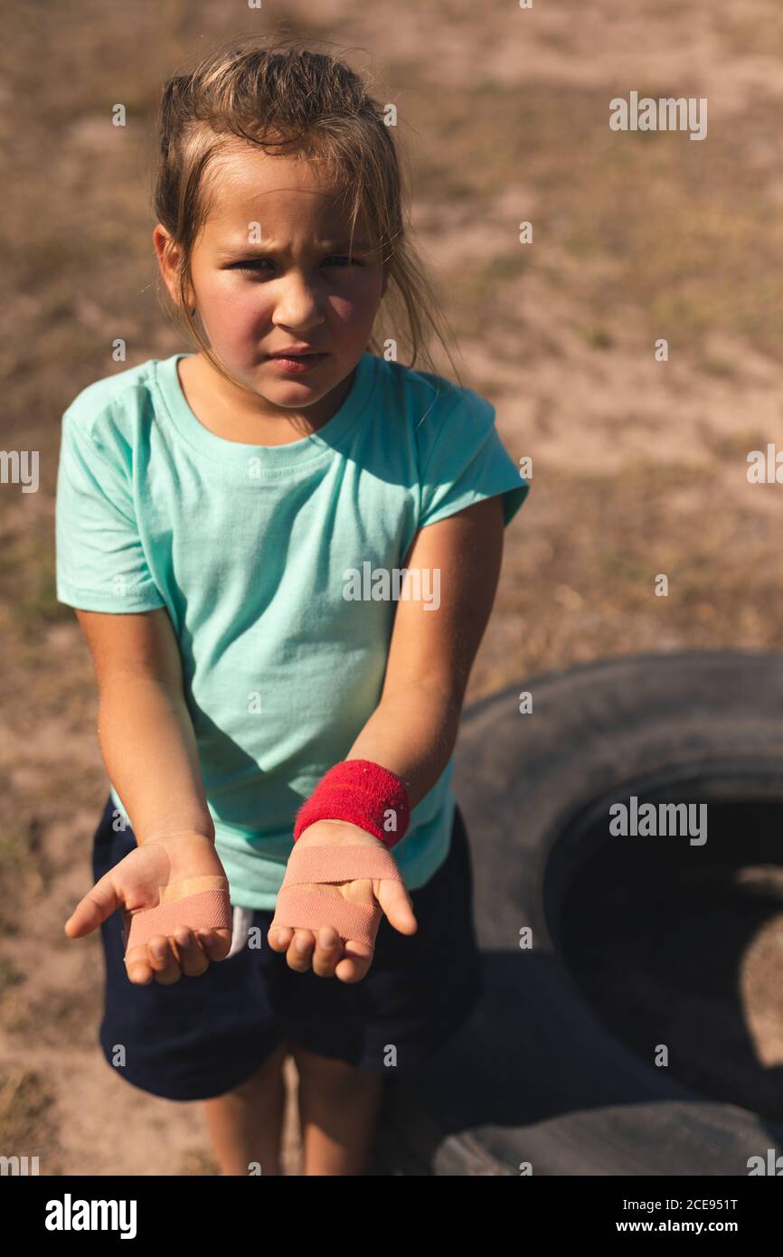 Girl showing her injured hands at a bootcamp Stock Photo - Alamy