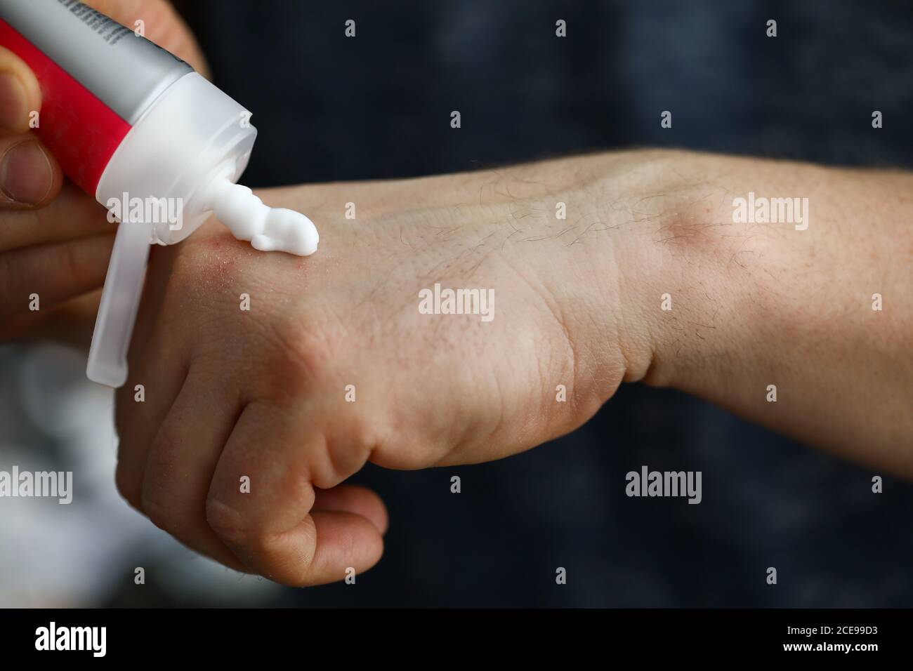 Man squeezes cream on his hand to moisturize skin Stock Photo - Alamy
