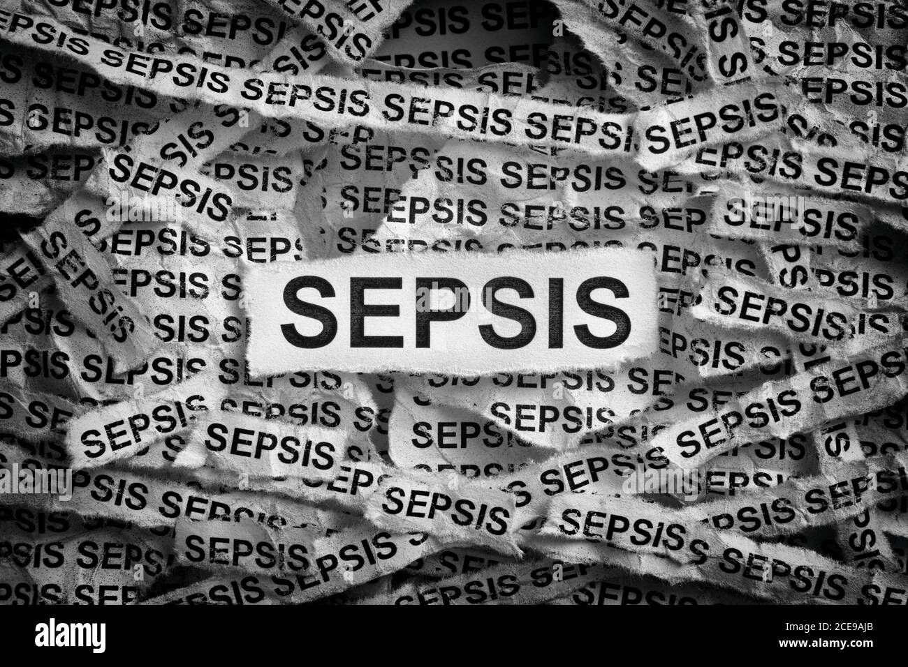 Sepsis infection hi-res stock photography and images - Alamy