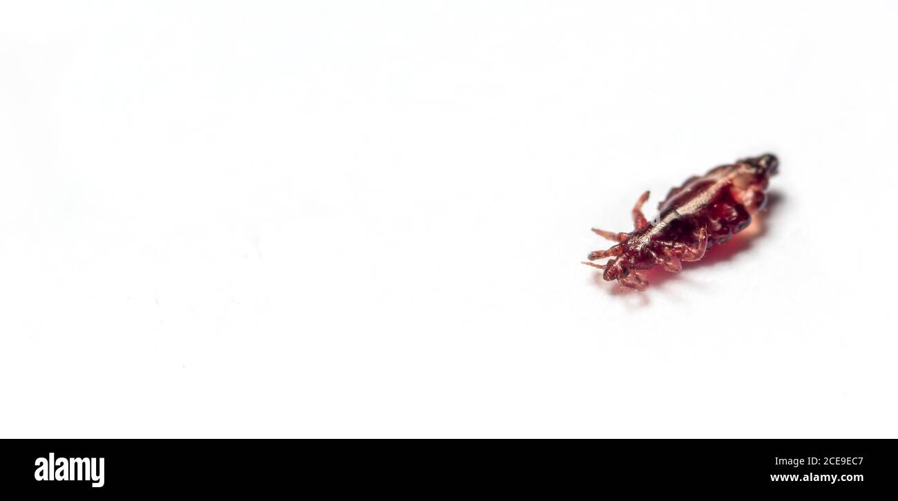 Head lice hi-res stock photography and images - Alamy