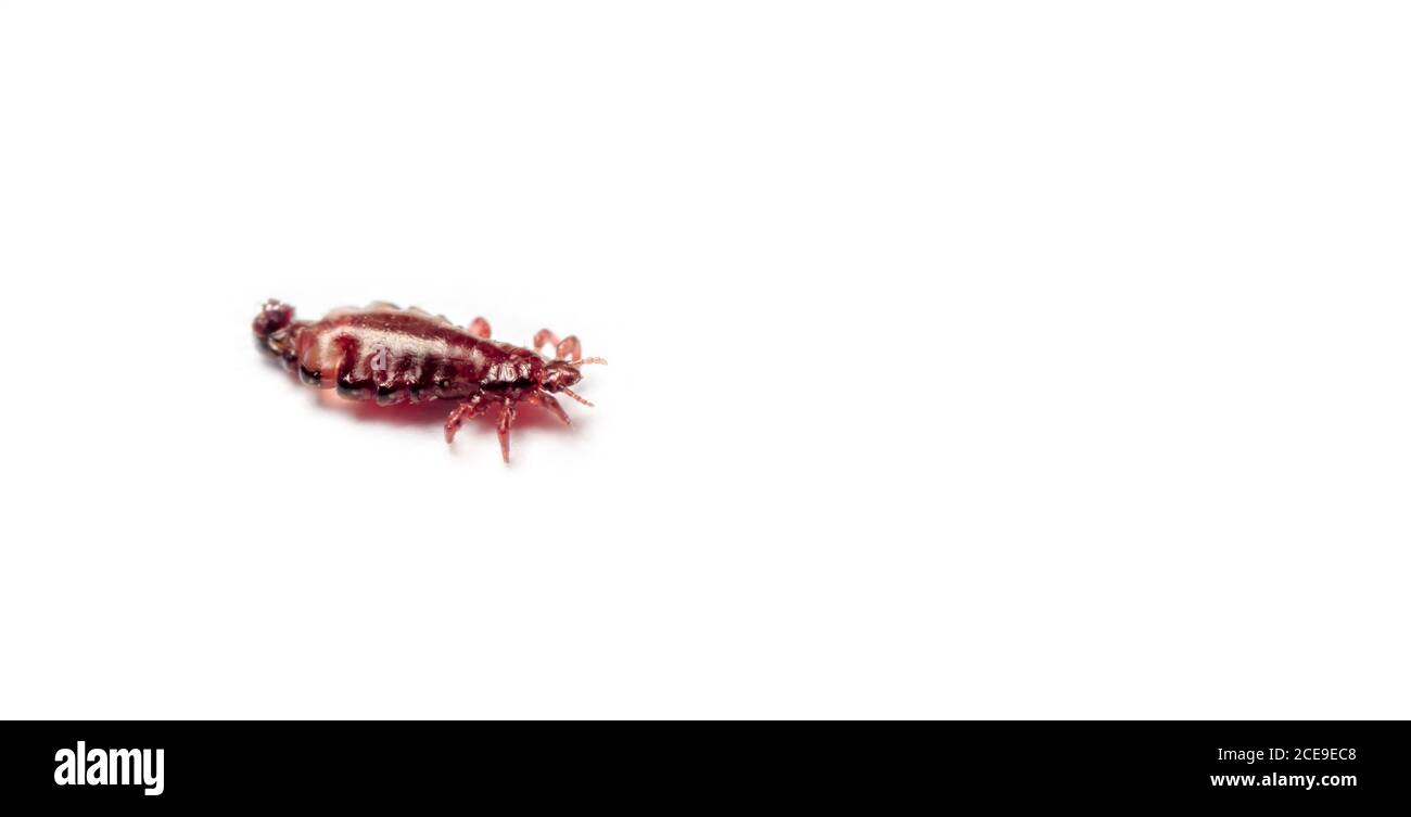 Head lice hi-res stock photography and images - Alamy