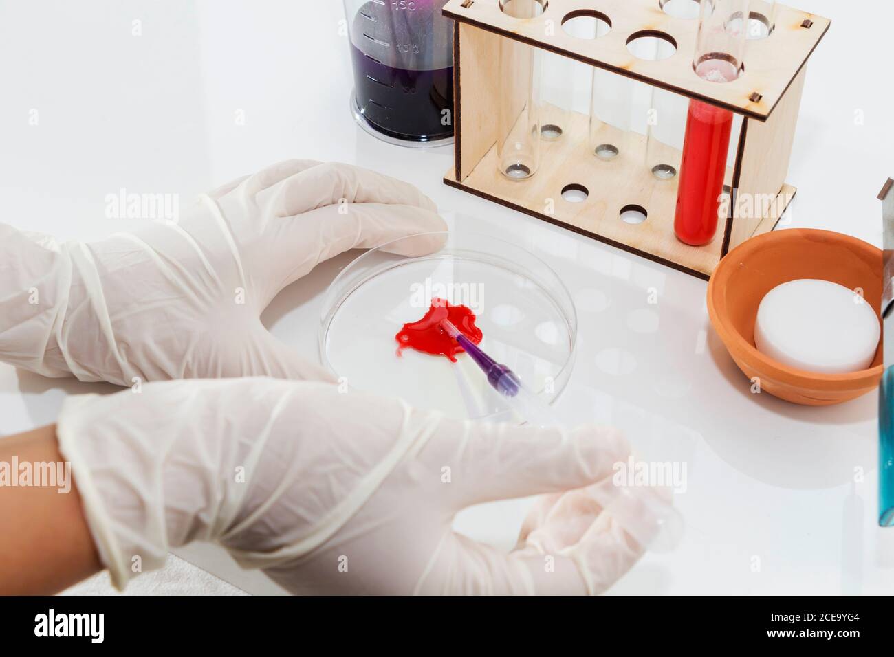 the medical doctor's hand works with a sample of blood, vial and flask ...