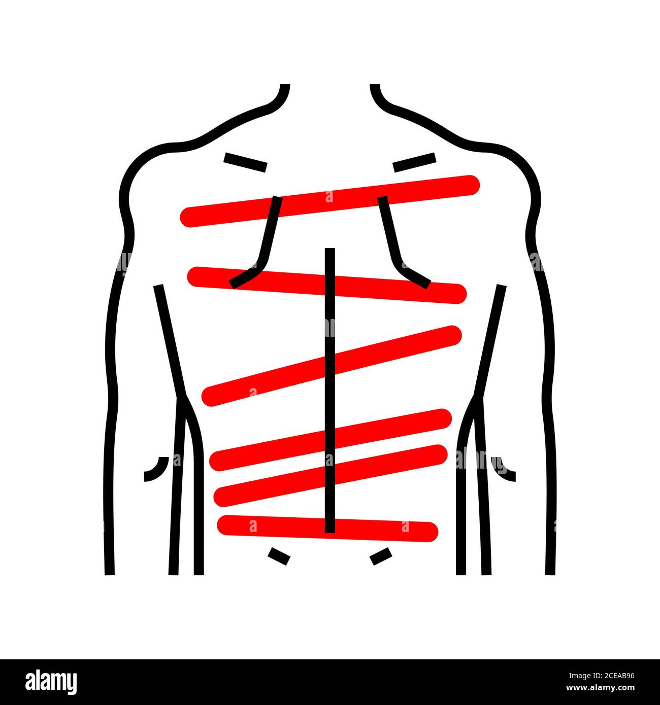 Woman scar back Stock Vector Images - Alamy