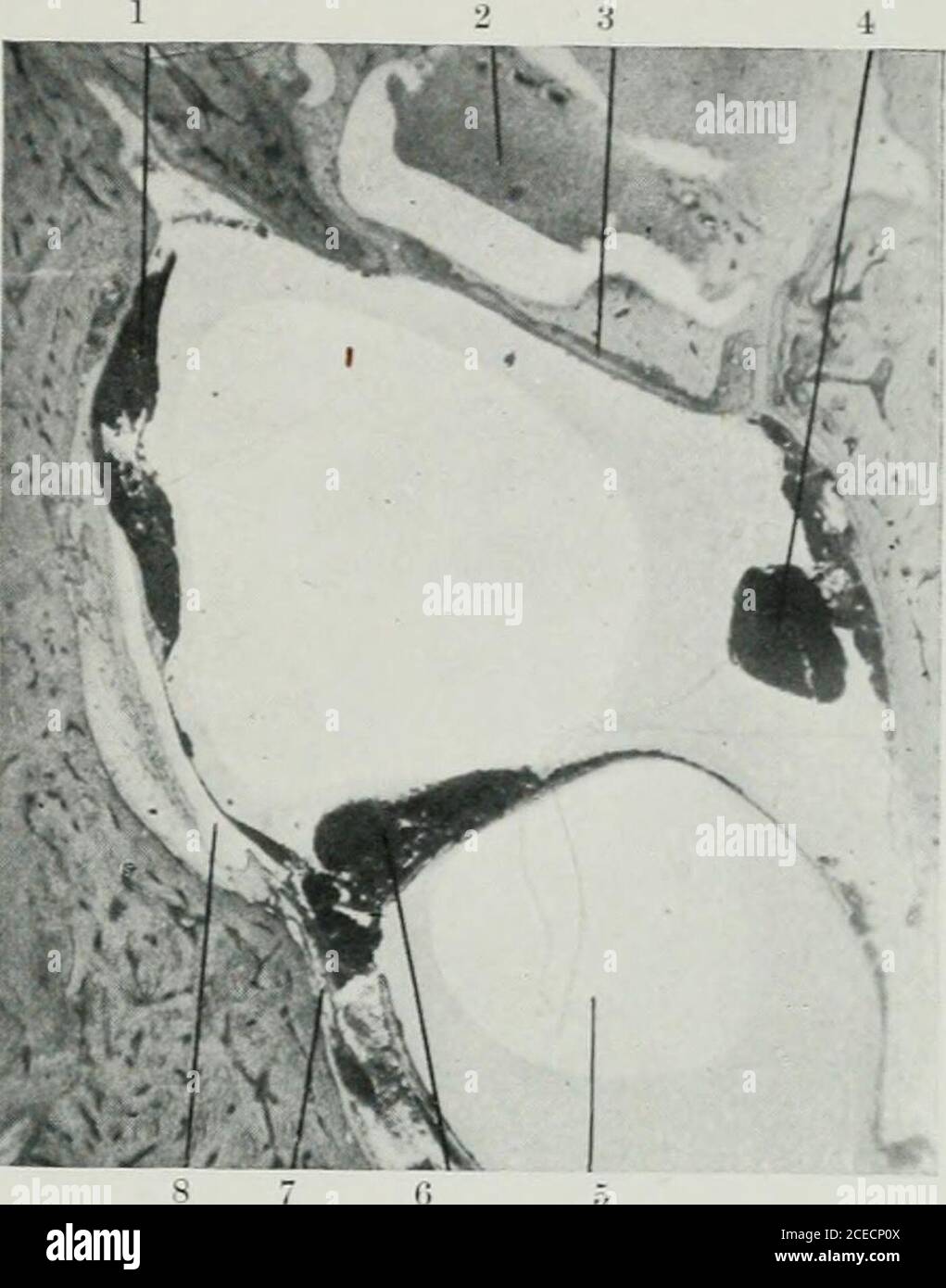 . The Journal of laryngology and otology. Fig. 9.—Horizontal section ...