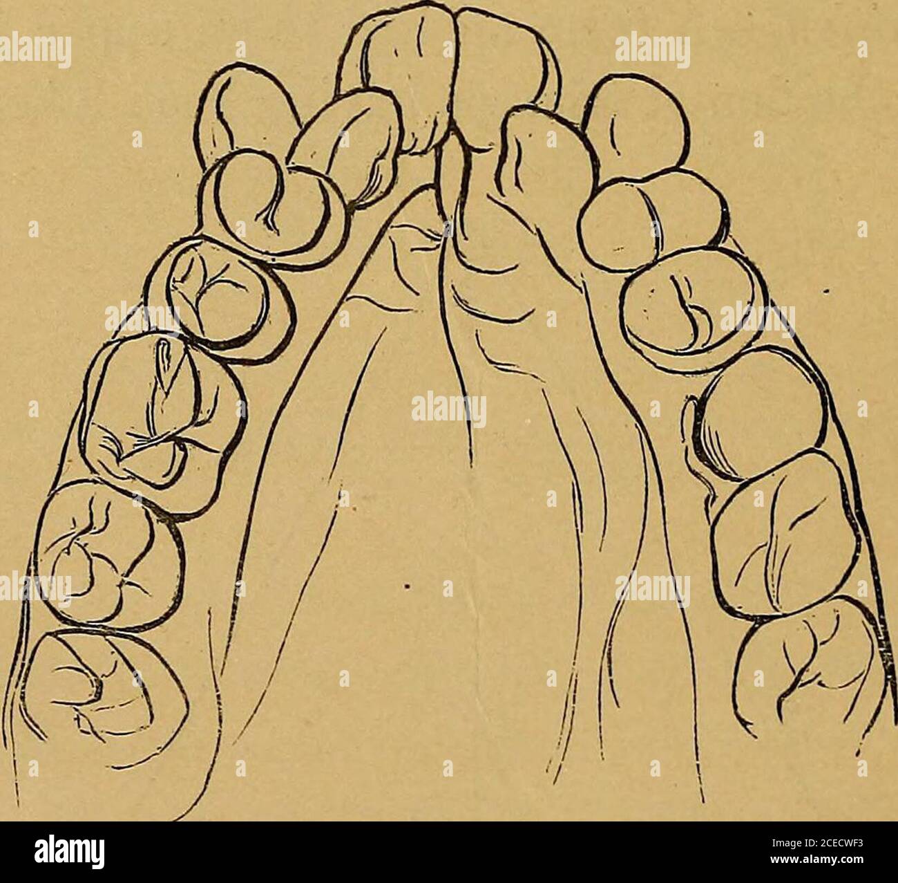 . Deformities of the mouth : congenital and acquired, with their ...