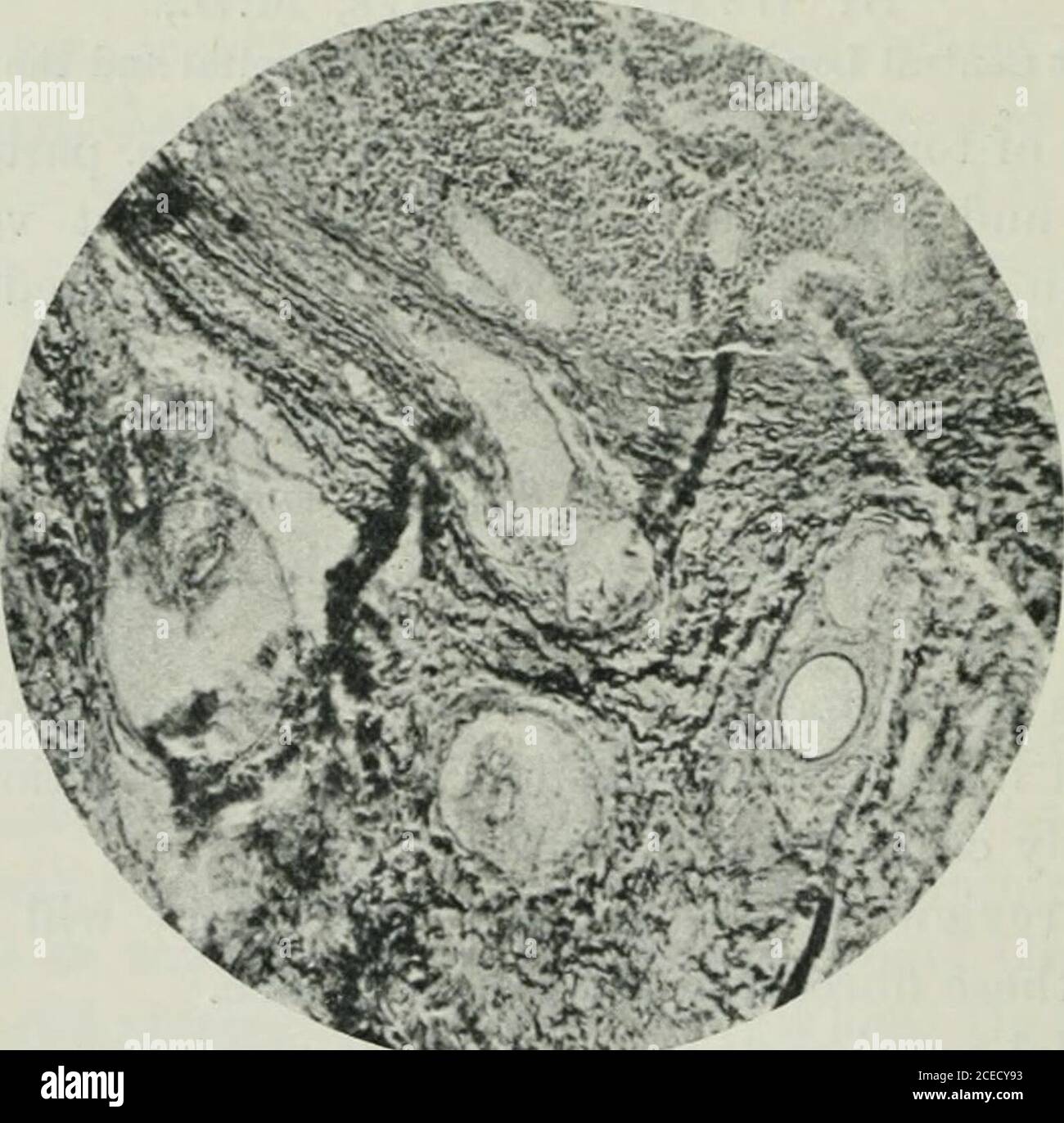 . The Journal of laryngology and otology. -^ Fig. 1 is a section ...