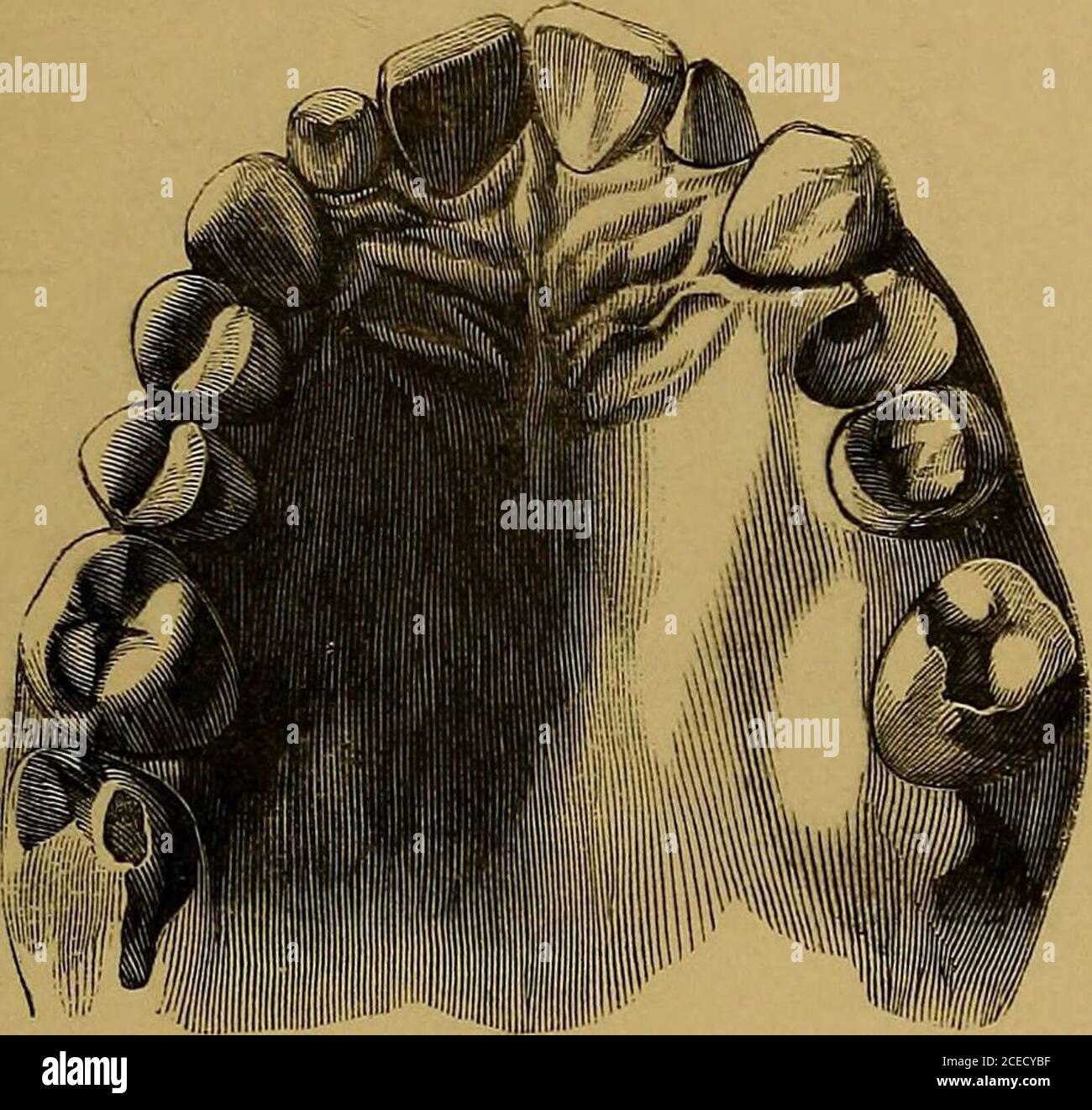 . Deformities of the mouth : congenital and acquired, with their ...