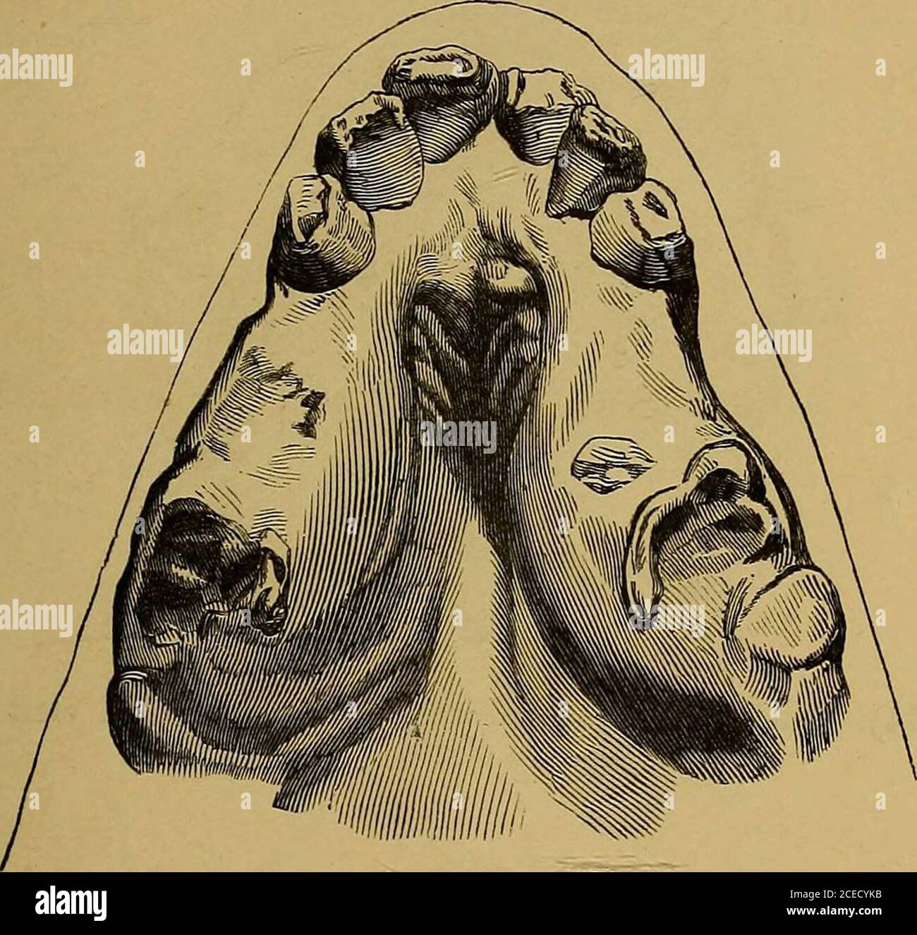 . Deformities of the mouth : congenital and acquired, with their ...