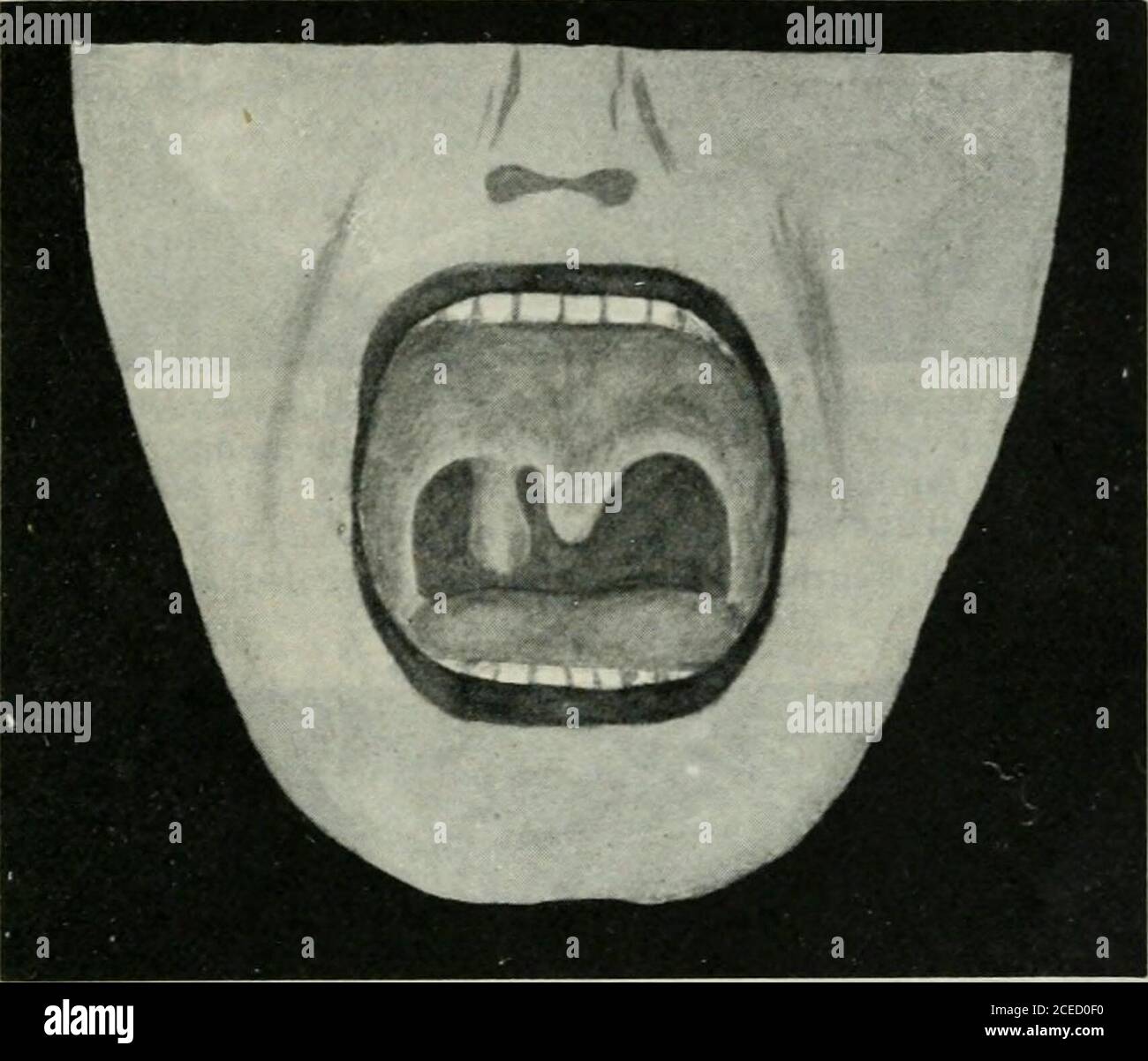 Boy uvula hi-res stock photography and images - Alamy