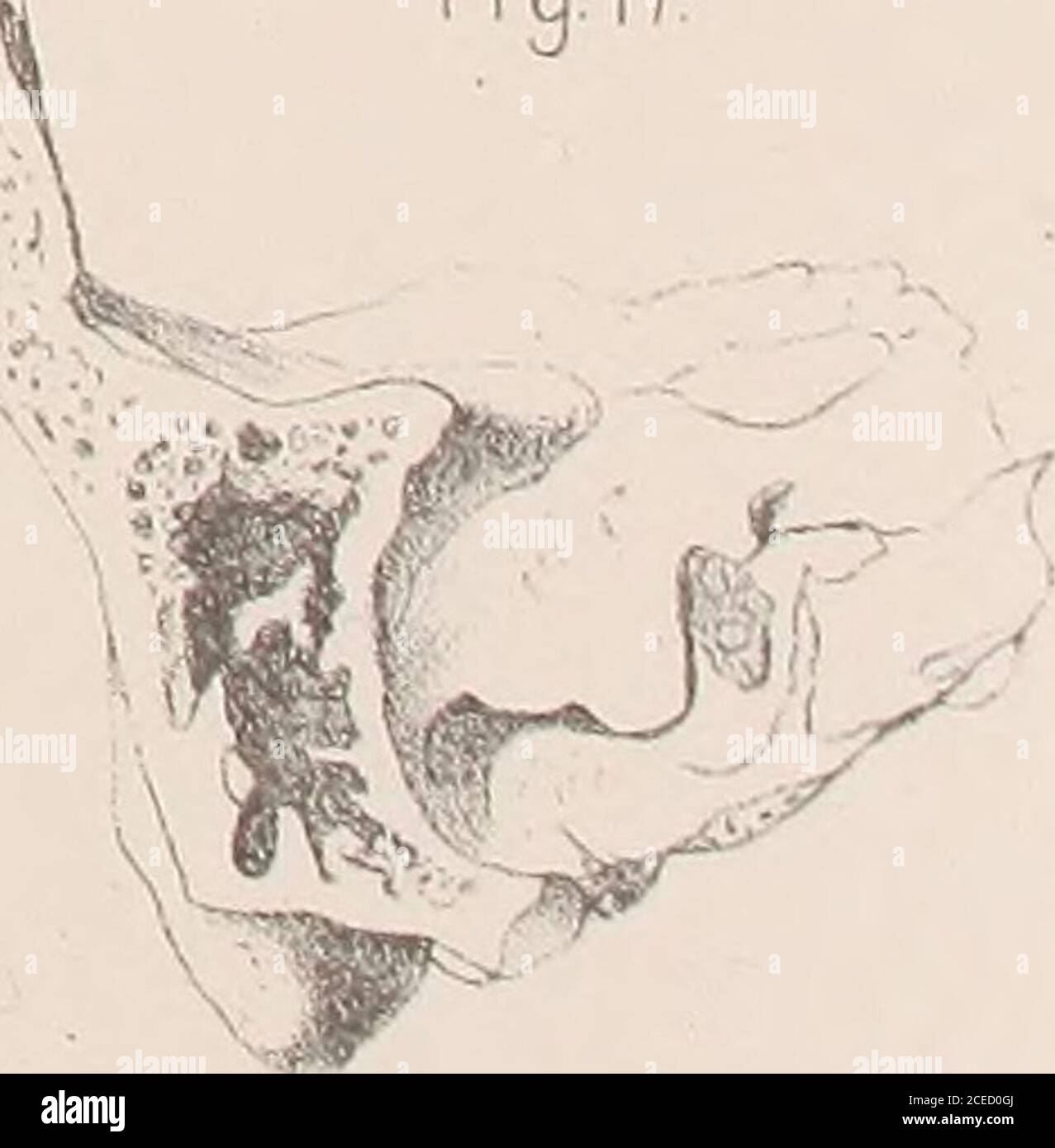 Kopf 17 3 8 hi-res stock photography and images - Alamy