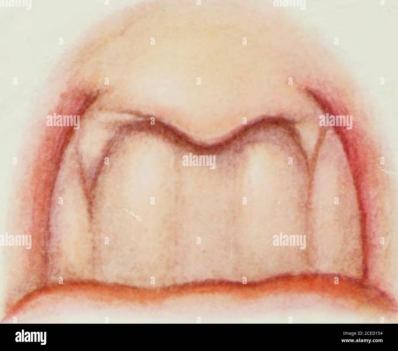 . The Journal of laryngology and otology. t is unnecessary ...