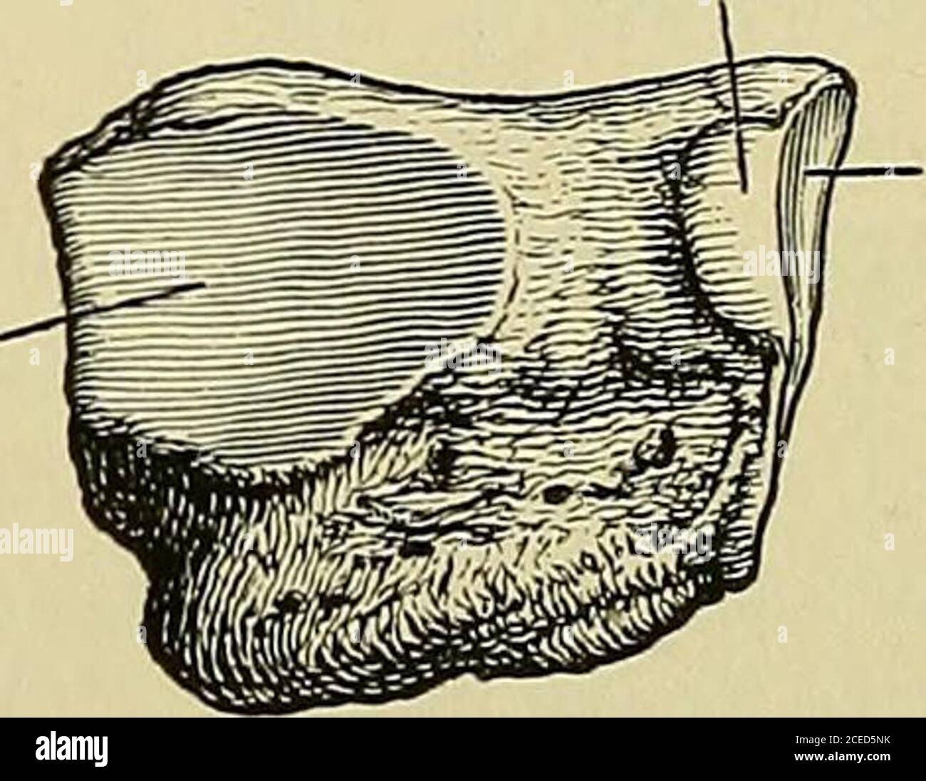 . Quain's Elements of anatomy. Fig. 150. —Right external cuneiporm bone ...