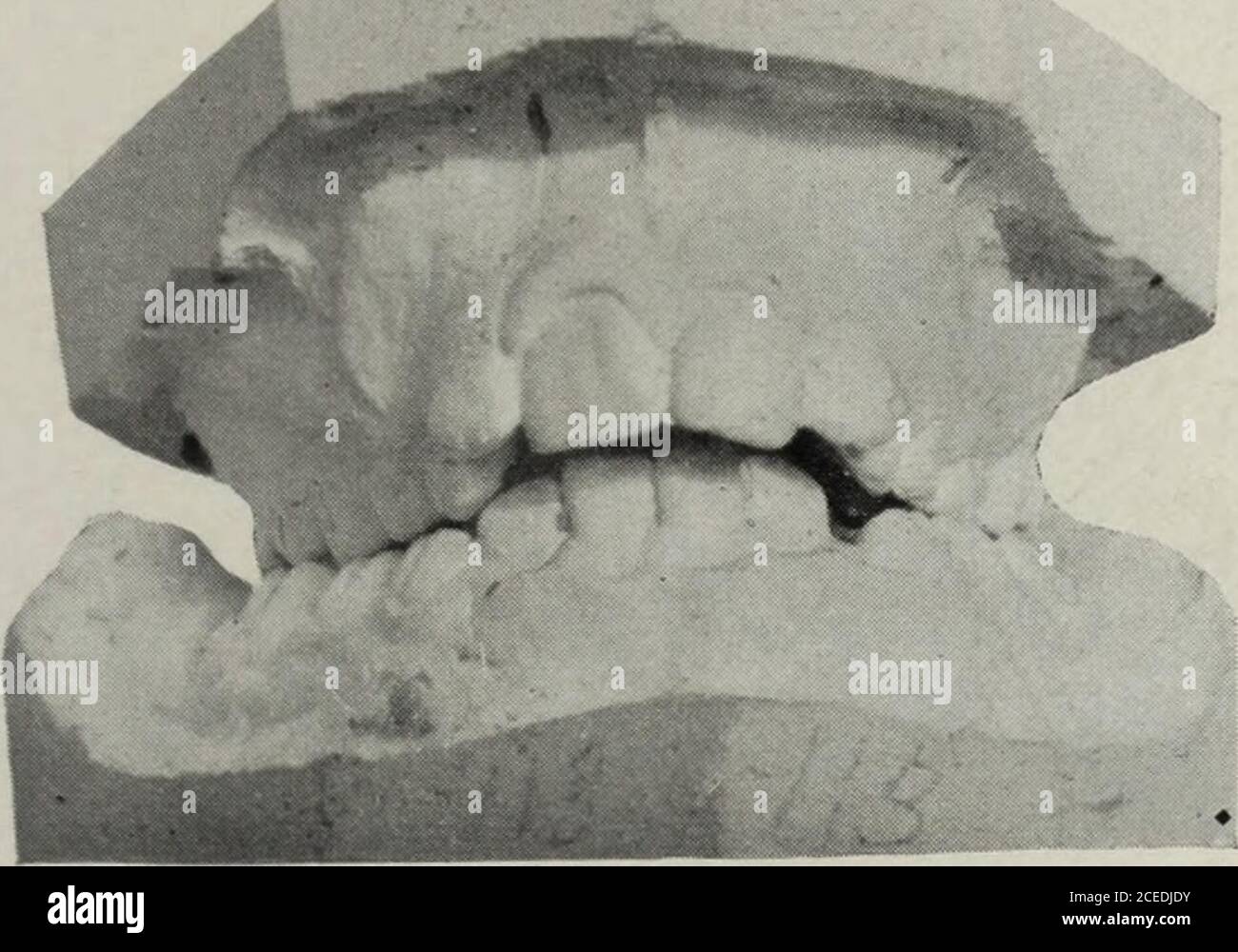 Torsal hi-res stock photography and images - Alamy