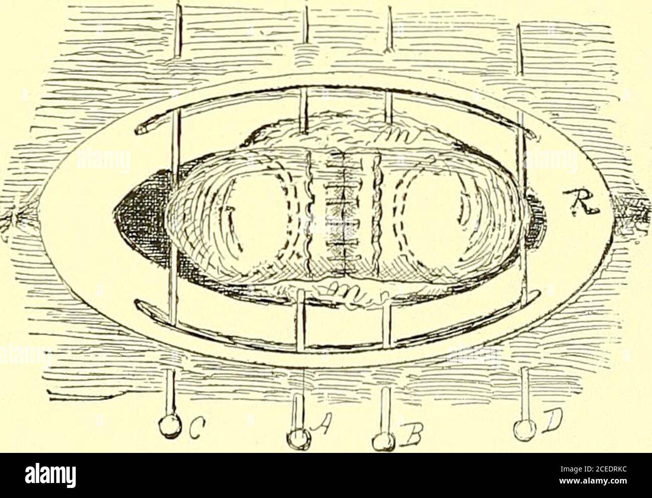 . The anatomy and surgical treatment of hernia. C^ OS Fig. 22. Fig. 23 ...