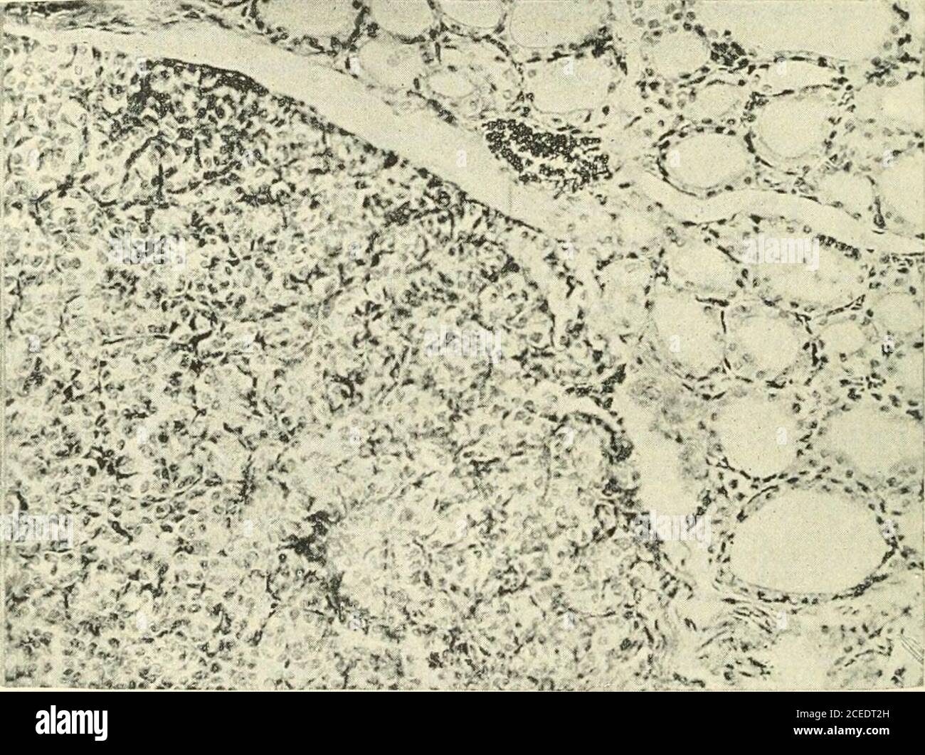 Autolysis hi-res stock photography and images - Alamy