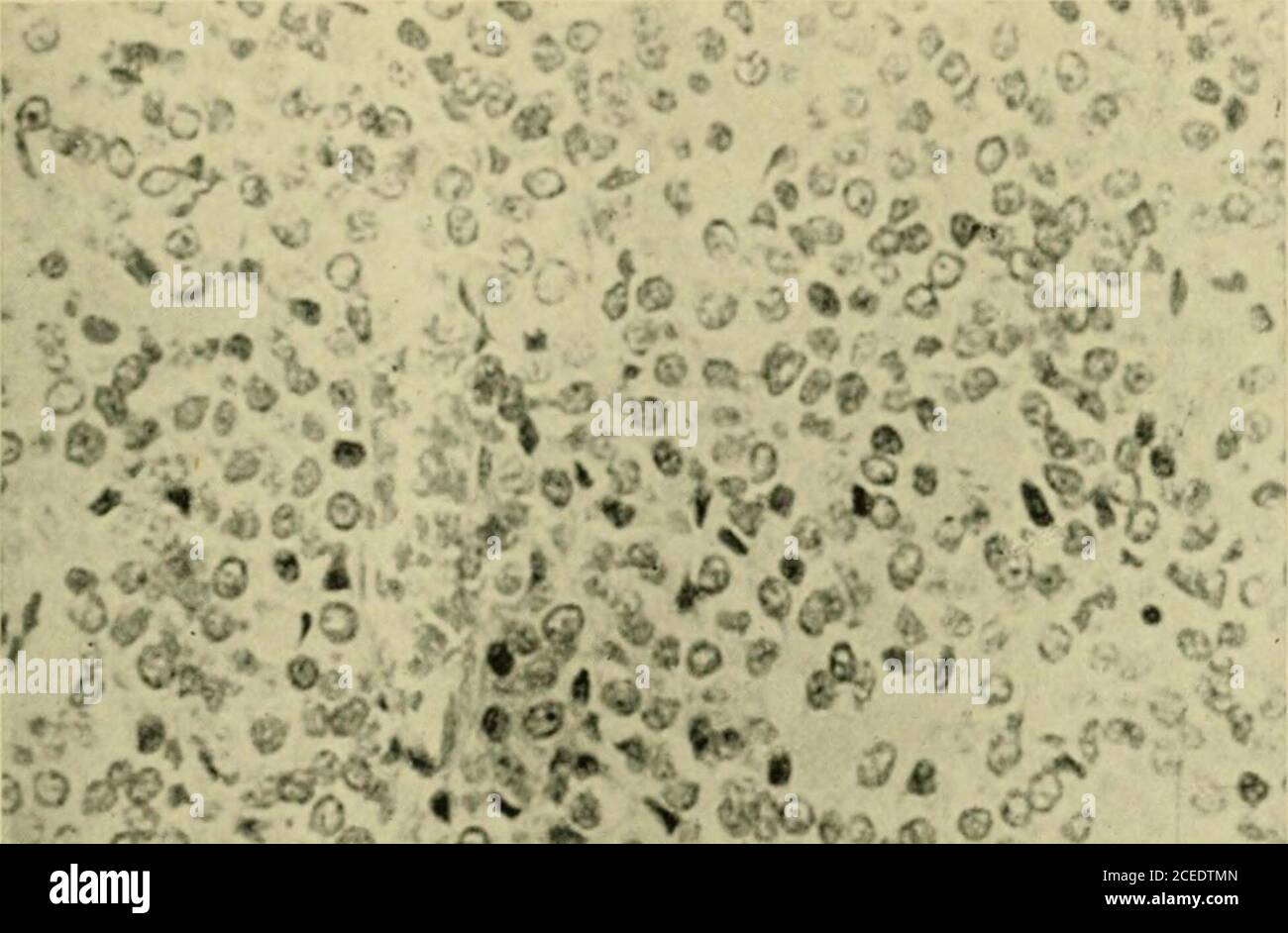 Oxyphil hi-res stock photography and images - Alamy