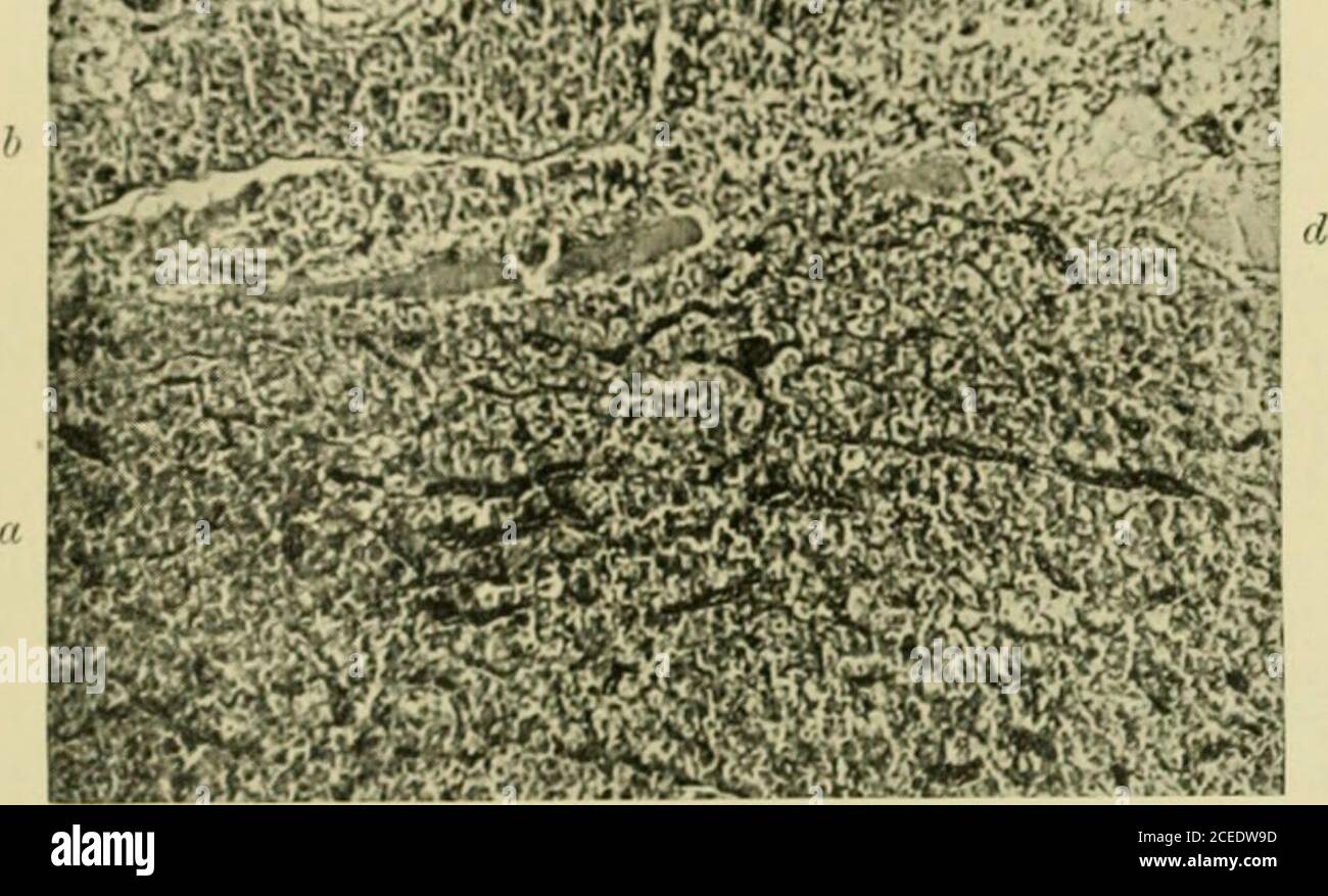 Pituitary pars intermedia hi-res stock photography and images - Alamy